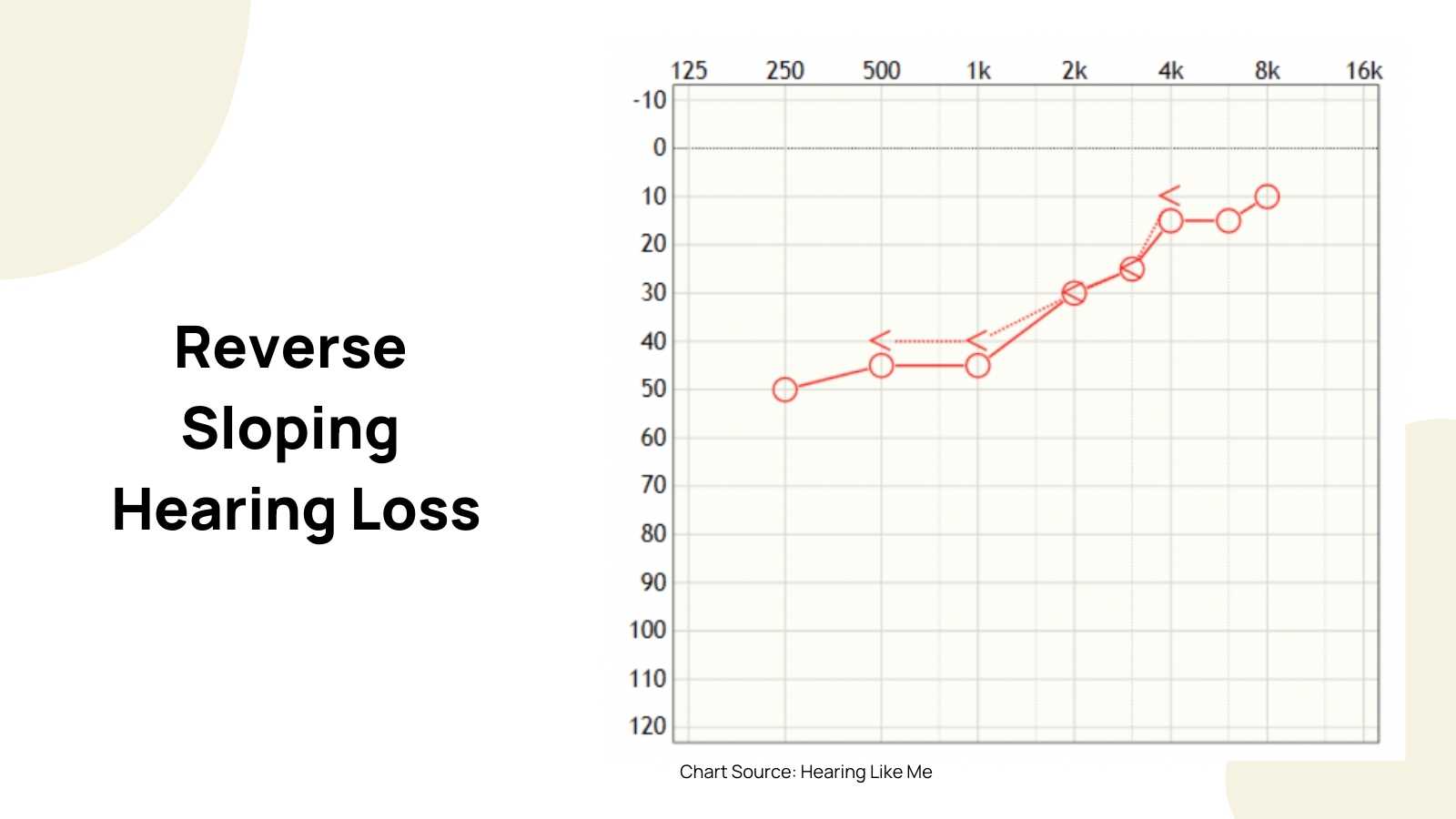 Normal Hearing Range Graph